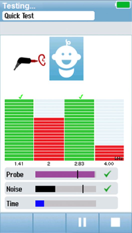 GSI Novus™ | บริษัท มารุ่งโรจน์ จำกัด | เครื่องช่วยฟัง เครื่องมือแพทย์