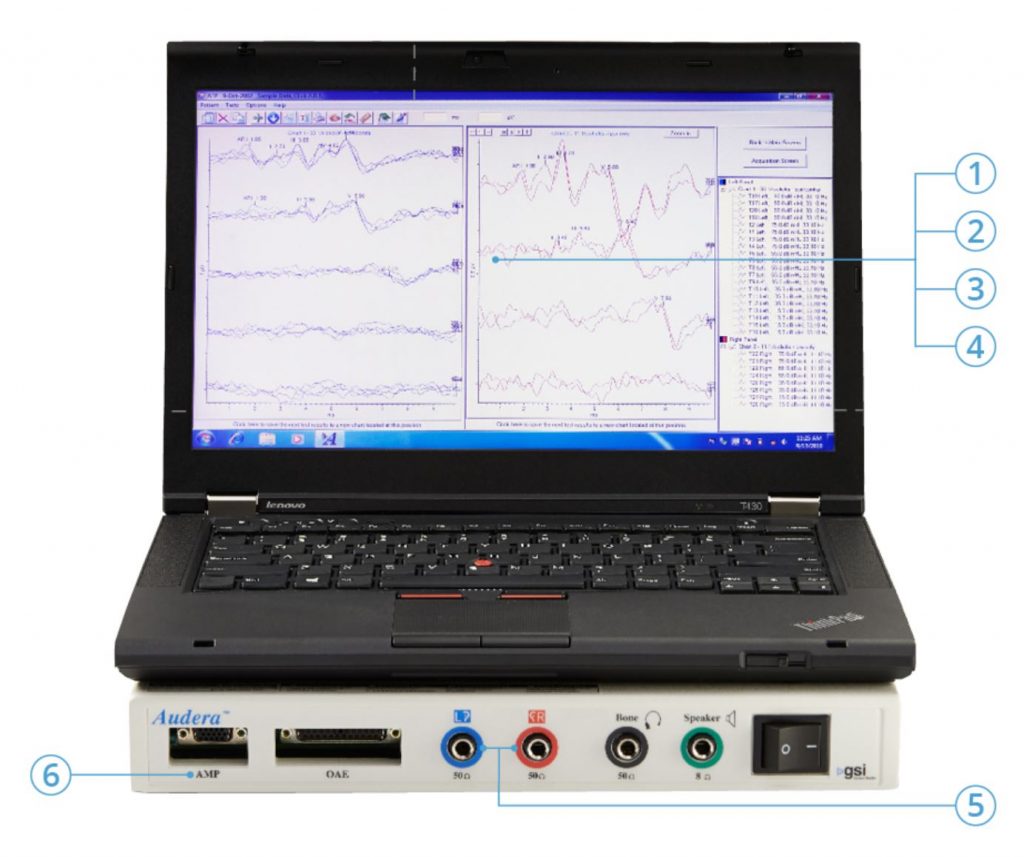 GSI Audera™ | บริษัท มารุ่งโรจน์ จำกัด | เครื่องช่วยฟัง เครื่องมือแพทย์